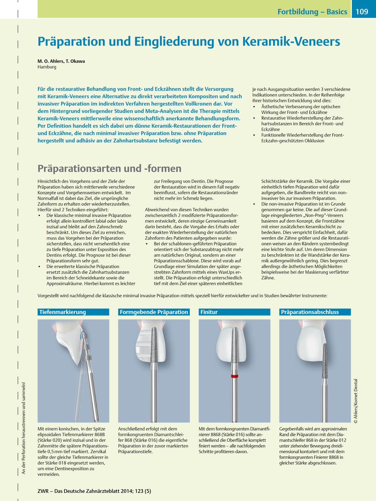 FB | Präparation und Eingliederung von Keramik-Veneers › Komet Dental