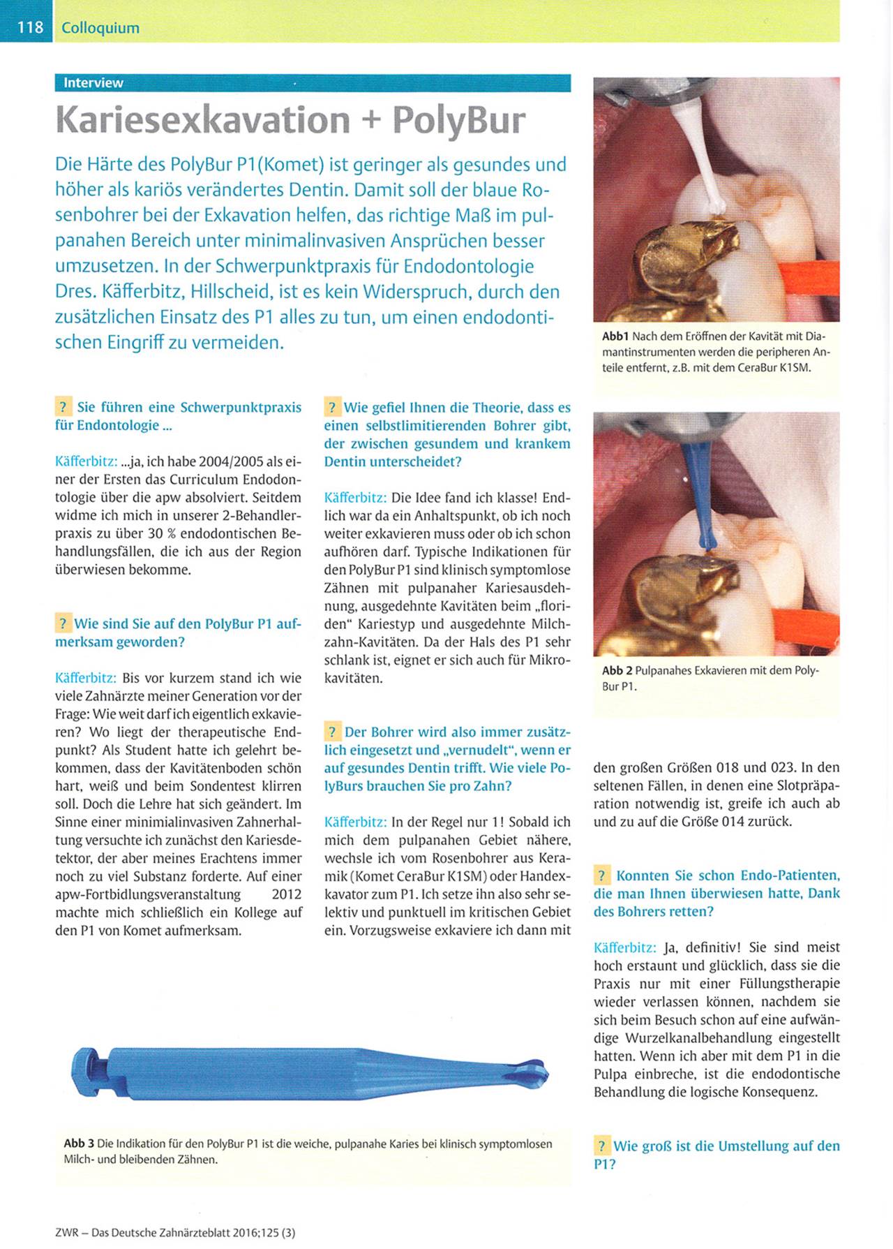 FB | Kariesexkavation + Polybur › Komet Dental