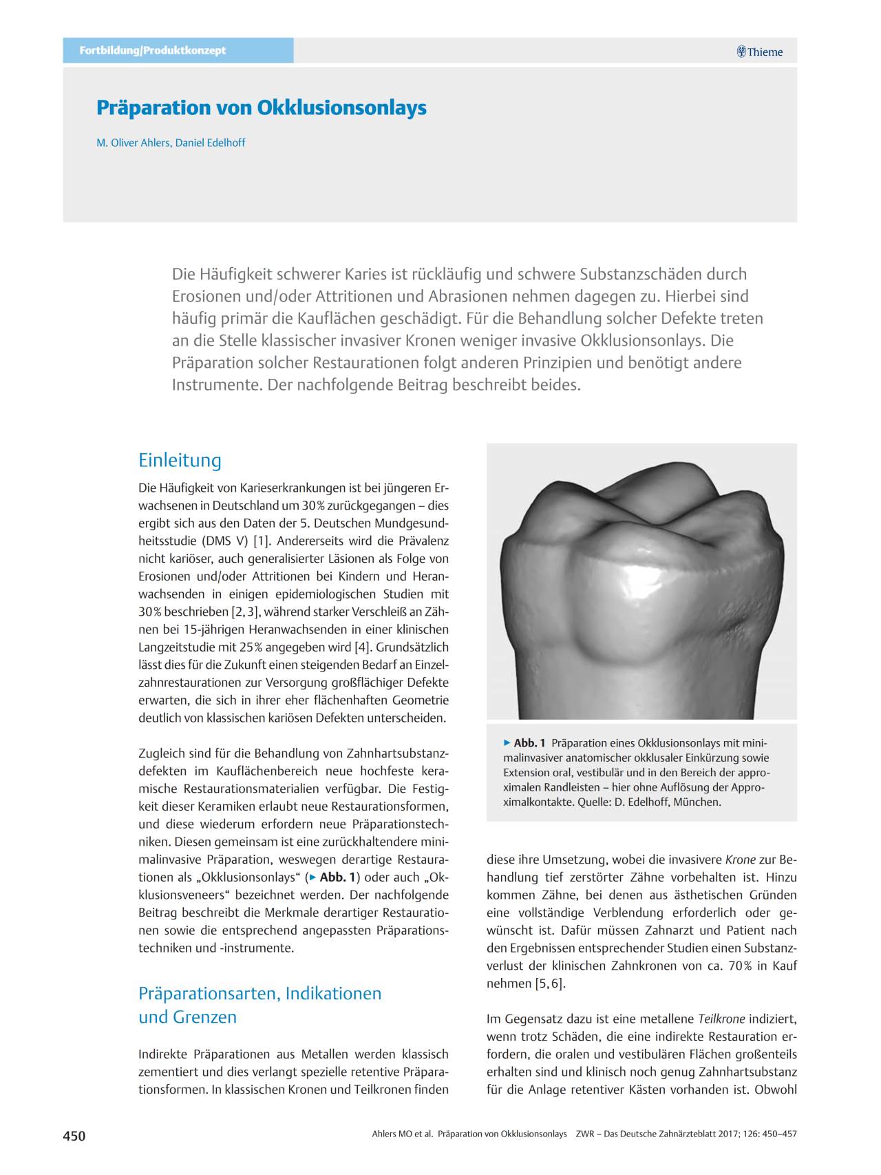 FB | Präparation von Okklusionsonlays – Komet Dental