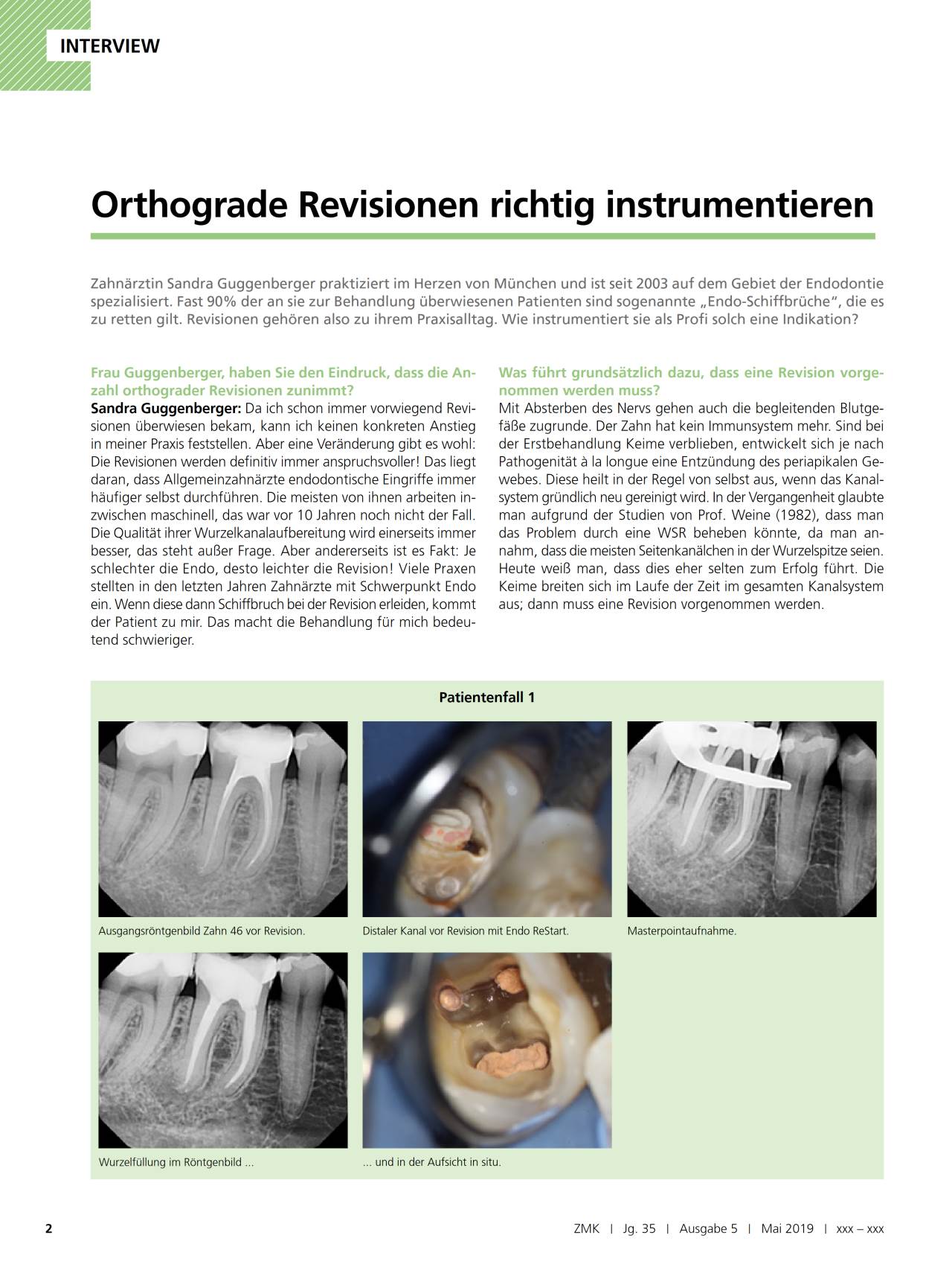 FB | Orthograde Revisionen richtig instrumentieren – Komet Dental