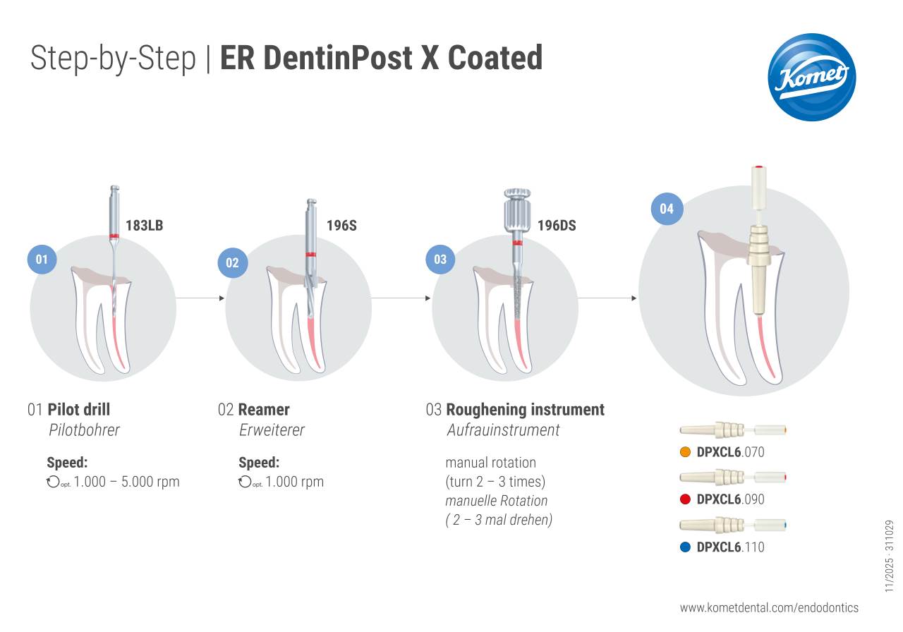 Step by Step | ER DentinPost X Coated – Komet Dental