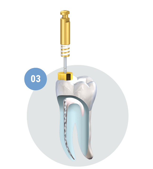 Endodontics › Komet Dental
