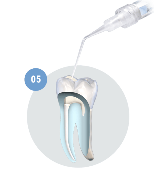 Endodontics › Komet Dental