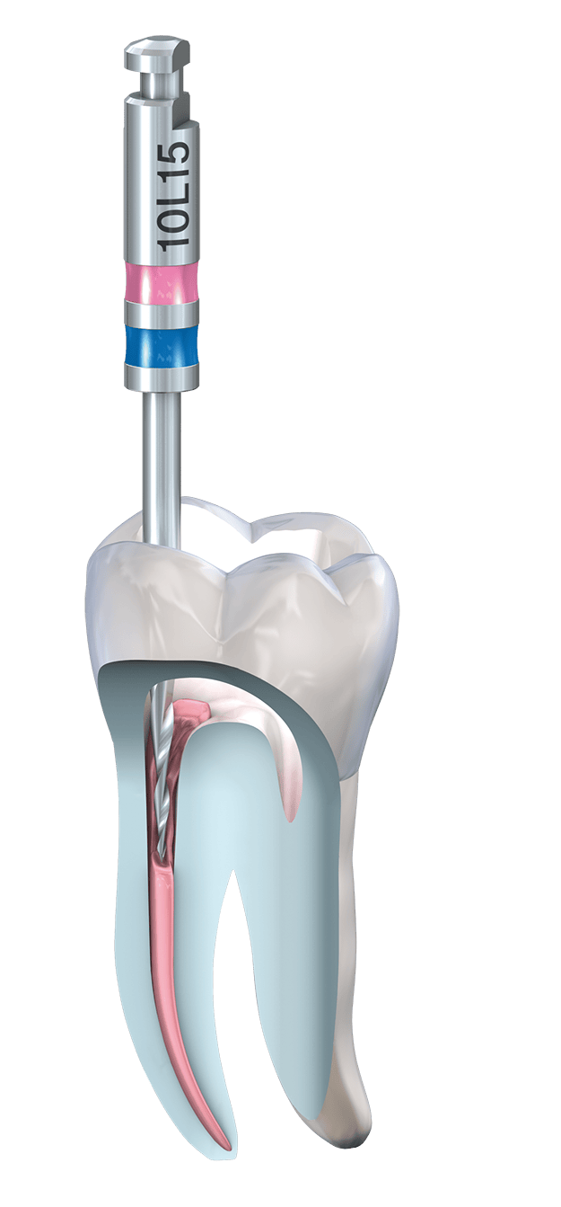 Retreatment › Komet Dental