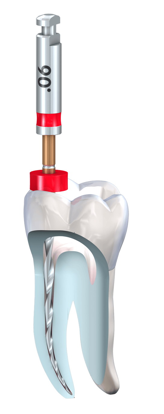 Retreatment › Komet Dental