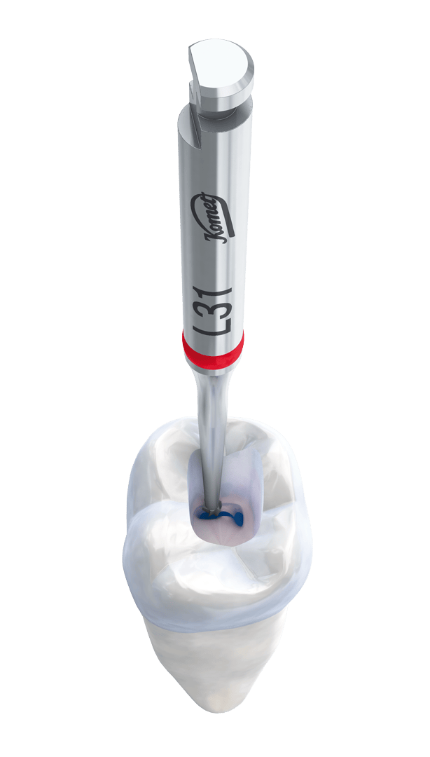 Access Cavity › Komet Dental