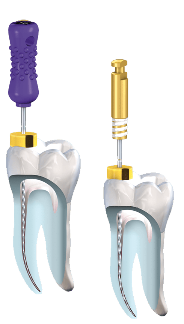 Creation of a glide path › Komet Dental