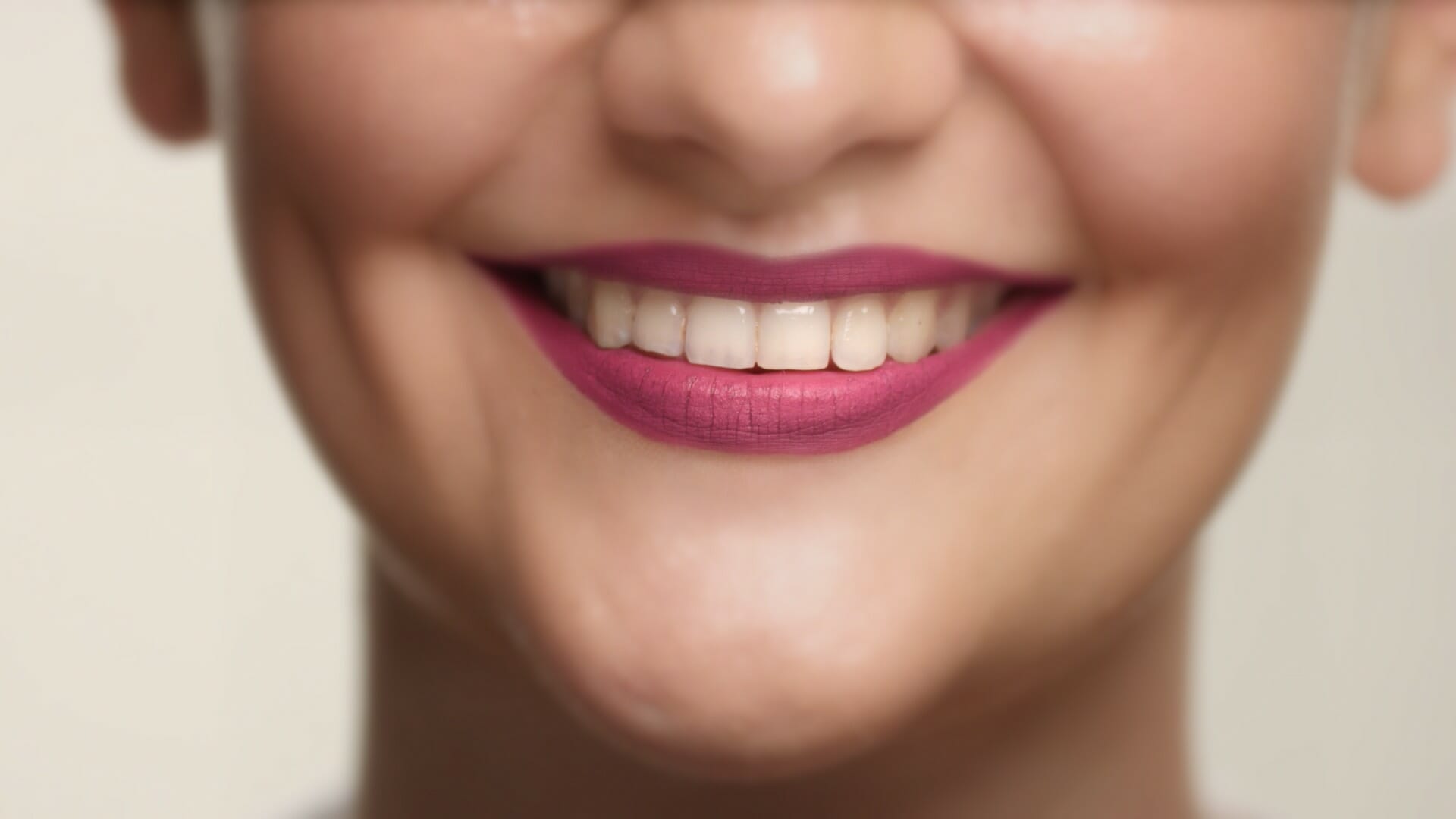 Perfect veneer preparations - Okklusionsonlay-Set – Komet Dental